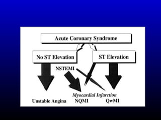 PCI in cardiology,indications, PCI in clinical practite ( stentst as ...