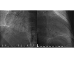 Peiman Jamshidi - Complication: How to Manage | PPT