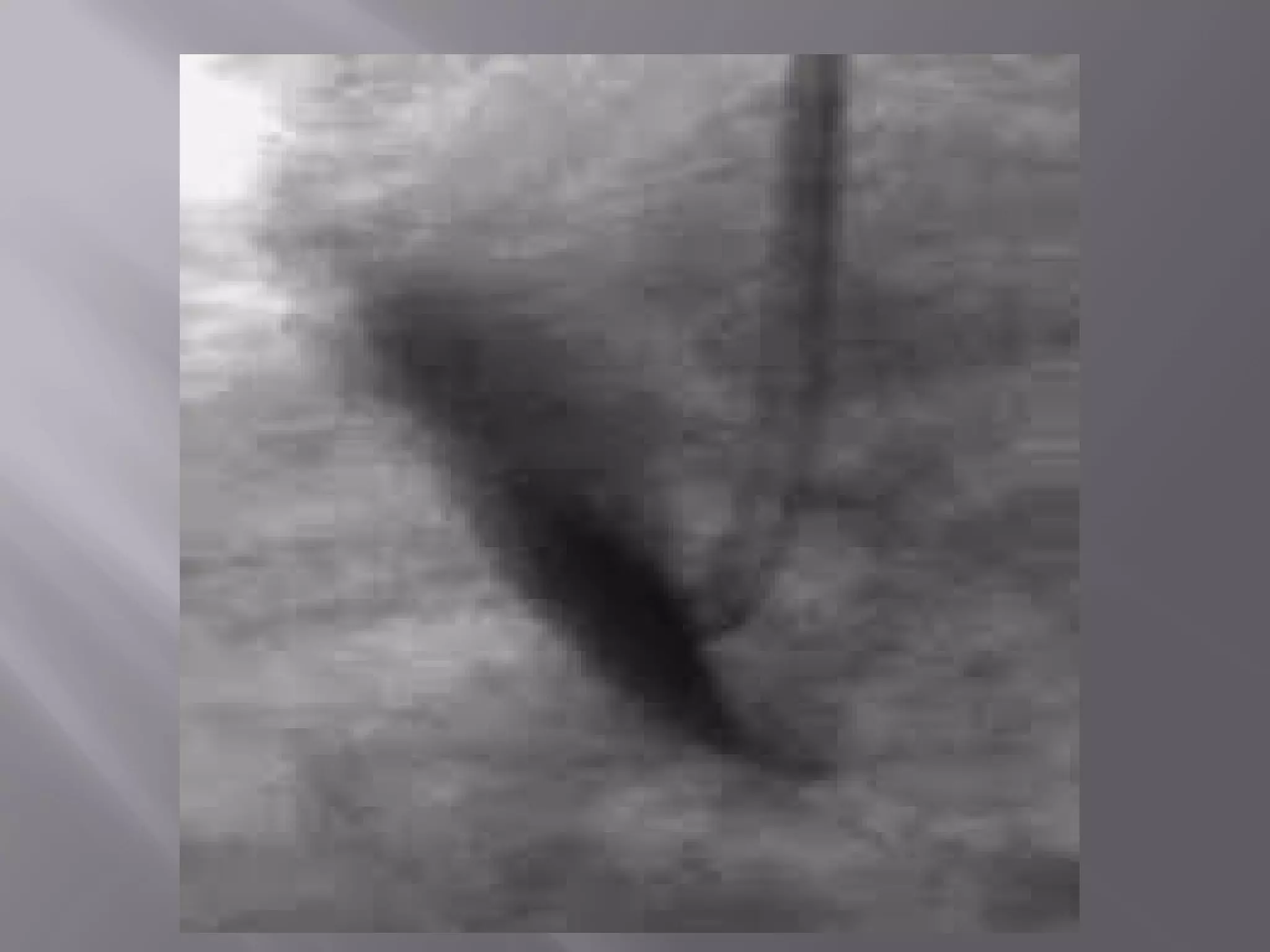 PCI procedure complication | ODP