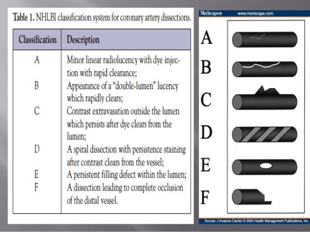 PCI procedure complication