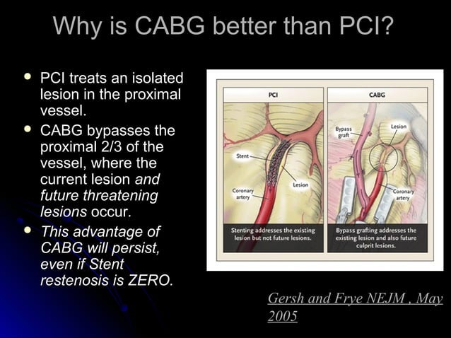 Pci vs cabg | PPT