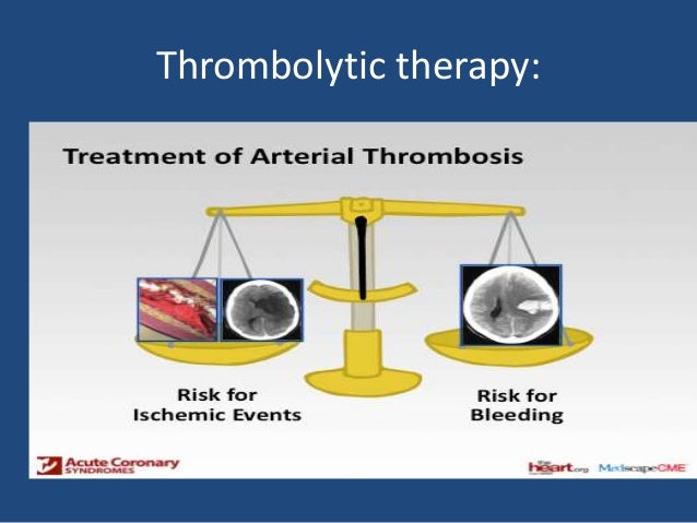 PCI vs. thrombolysis