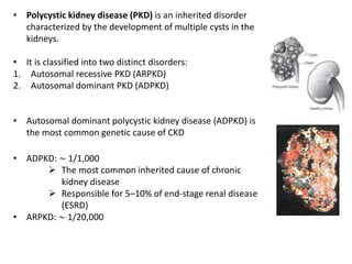 PCKD.pptx