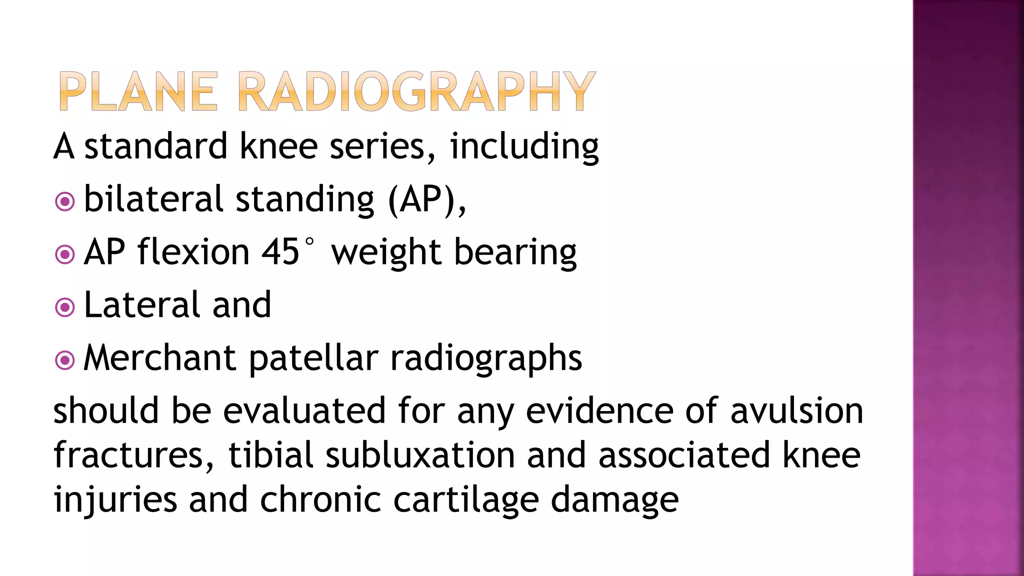 Posterior Cruciate Ligament Injury | PPT