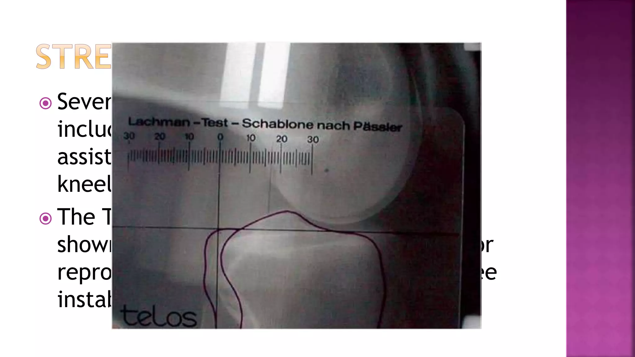 Posterior Cruciate Ligament Injury | PPT