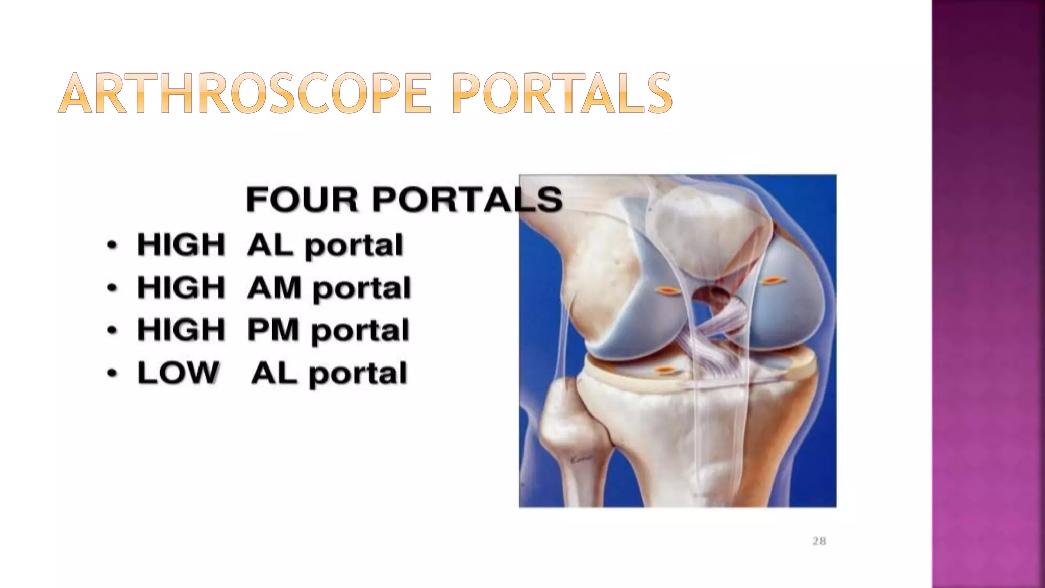 Posterior Cruciate Ligament Injury | PPT
