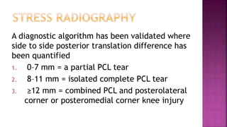 Posterior Cruciate Ligament Injury | PPT