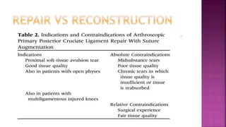 Posterior Cruciate Ligament Injury | PPT