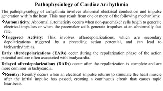 PCL 302 Arrhythmia.. Depth knowledge on arrhythmia | PPT