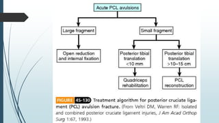 Pcl avulsion | PPTX