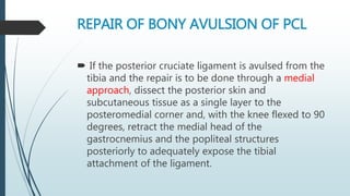 Pcl avulsion | PPTX