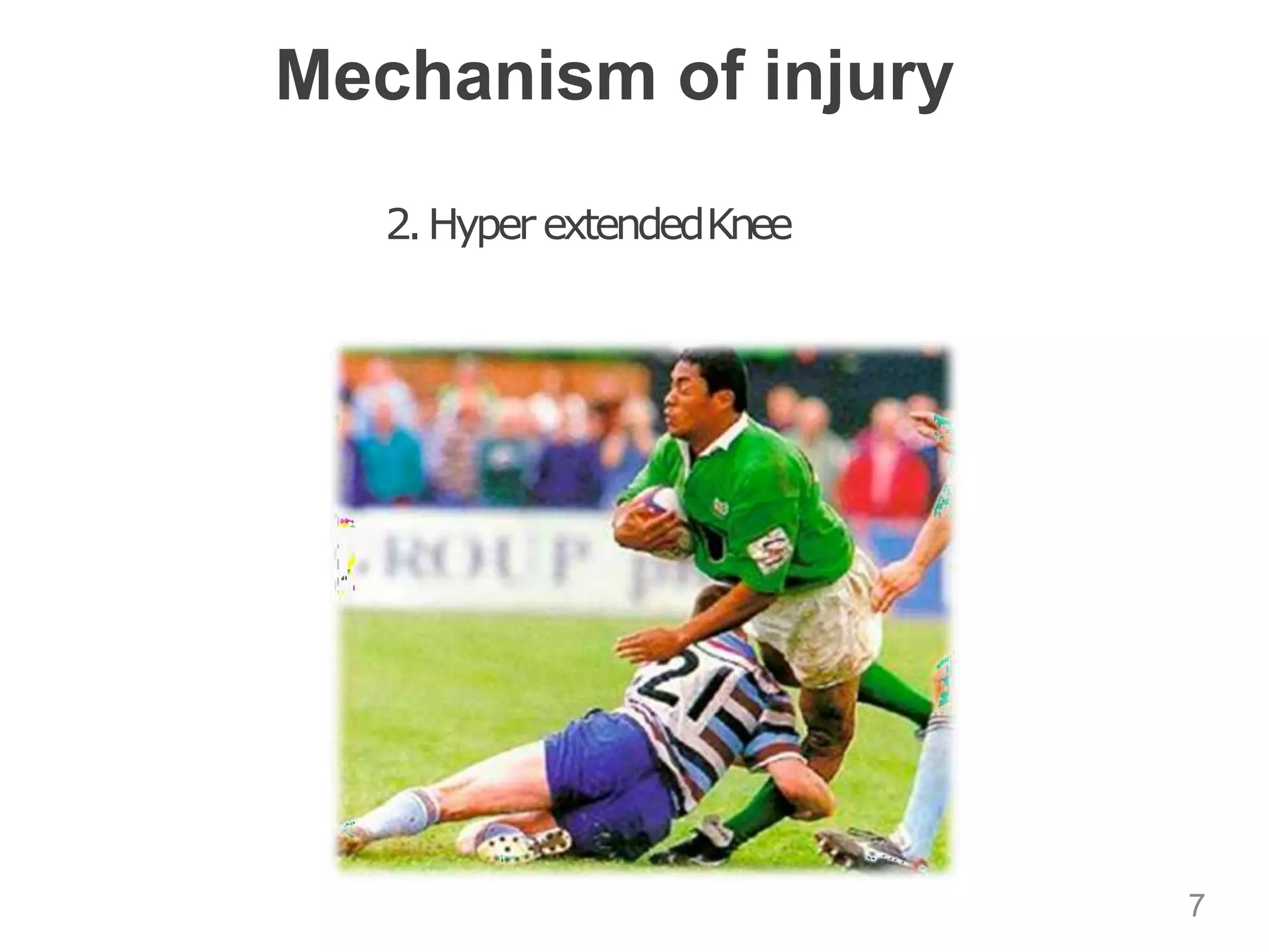 PCL POSTERIOR CRUCIATE LIGAMENT OF KNEE JOINT SPORTS INJURY: HOW TO ...