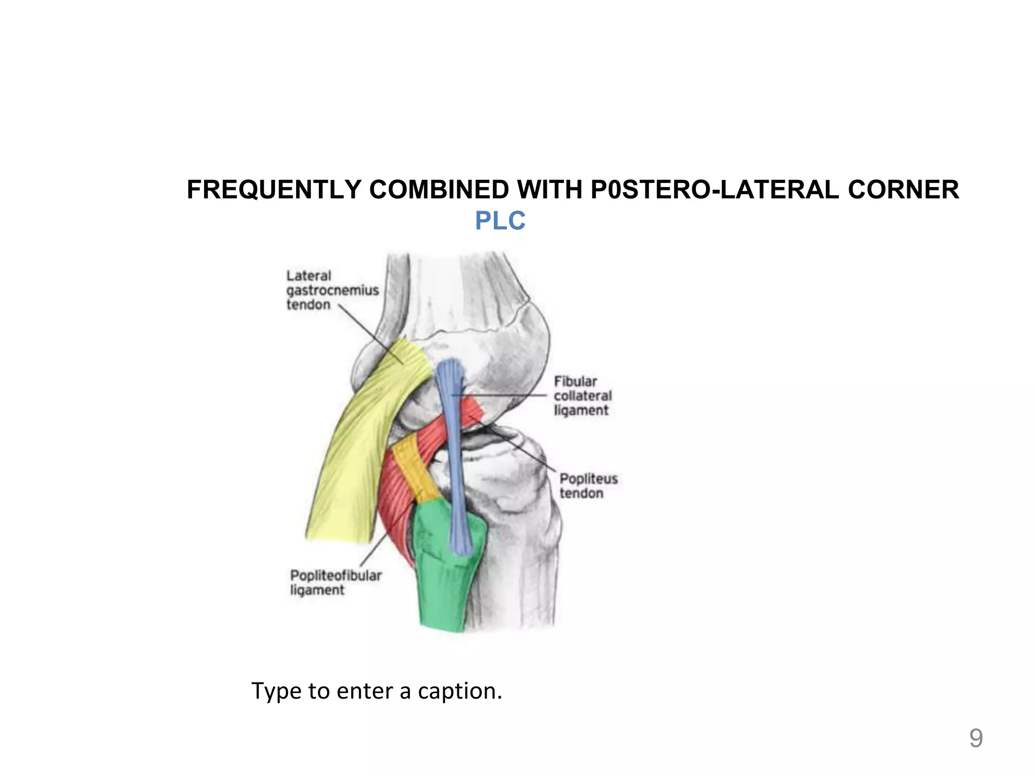PCL POSTERIOR CRUCIATE LIGAMENT OF KNEE JOINT SPORTS INJURY: HOW TO ...