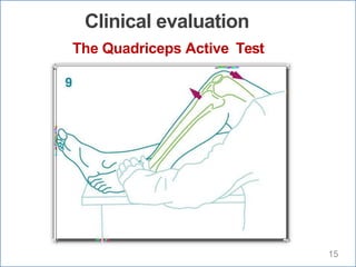 PCL POSTERIOR CRUCIATE LIGAMENT OF KNEE JOINT SPORTS INJURY: HOW TO ...
