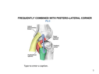 PCL POSTERIOR CRUCIATE LIGAMENT OF KNEE JOINT SPORTS INJURY: HOW TO ...