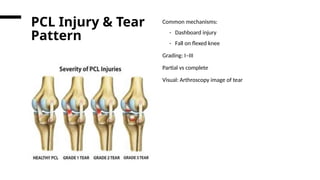 Posterior Cruciate Ligament- Surgical Anatomy | PPTX