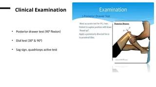 Posterior Cruciate Ligament- Surgical Anatomy | PPTX