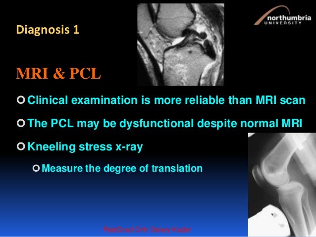 Updated PCL, PLC and Knee Dislocation for Postgraduate Orthopaedic Co…