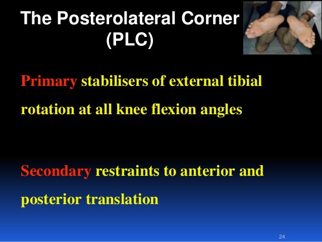 Updated PCL, PLC and Knee Dislocation for Postgraduate Orthopaedic Co…