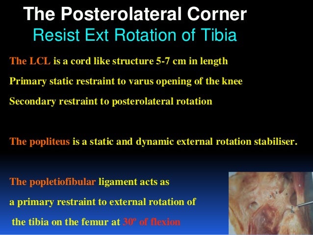 Updated PCL, PLC and Knee Dislocation for Postgraduate Orthopaedic Co…