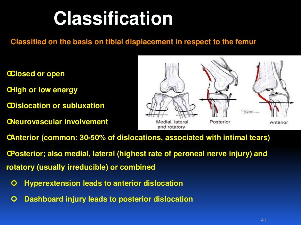 Updated PCL, PLC and Knee Dislocation for Postgraduate Orthopaedic Co…