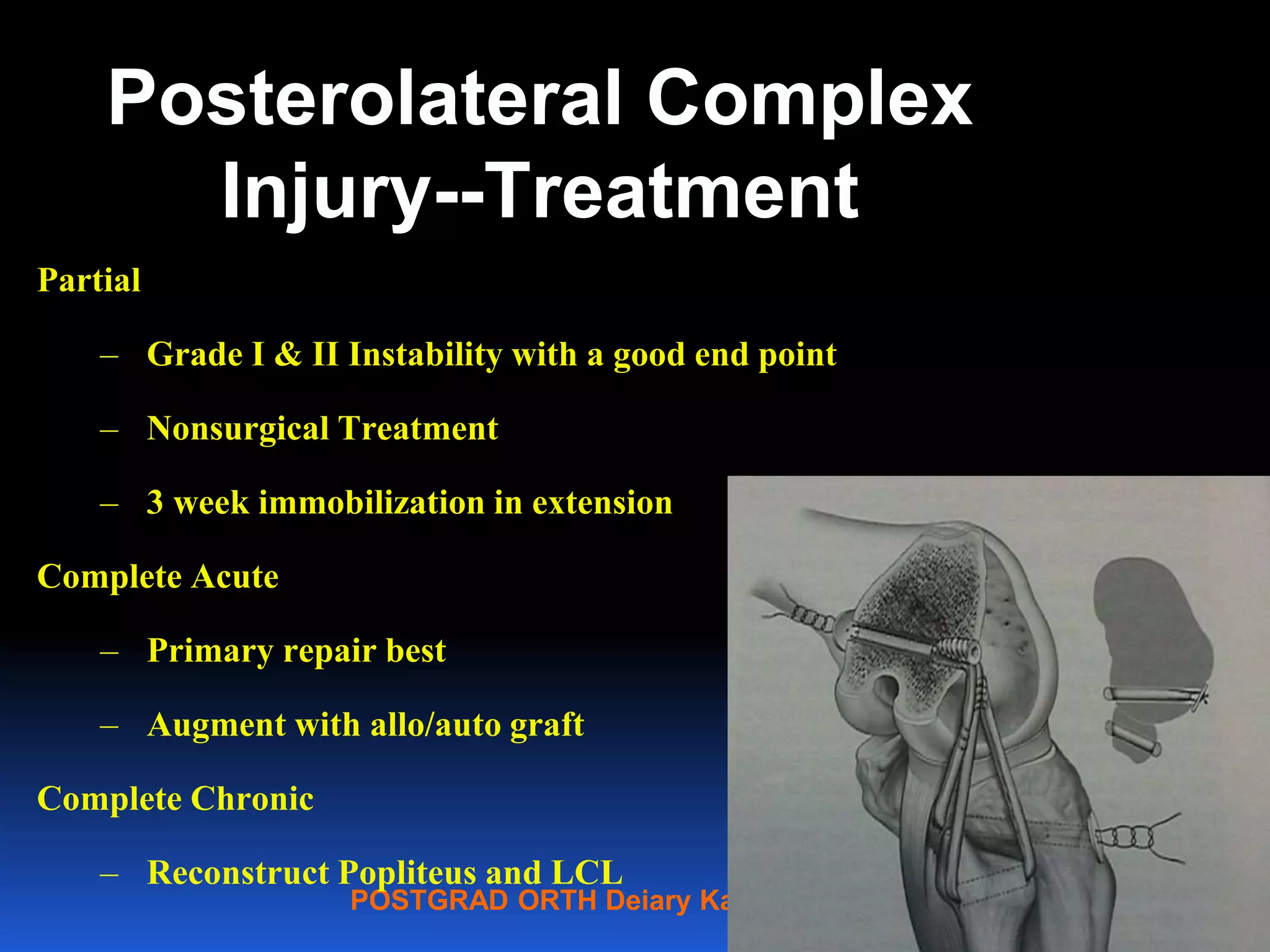 PCL, PLC, Knee Dislocation | PPTX