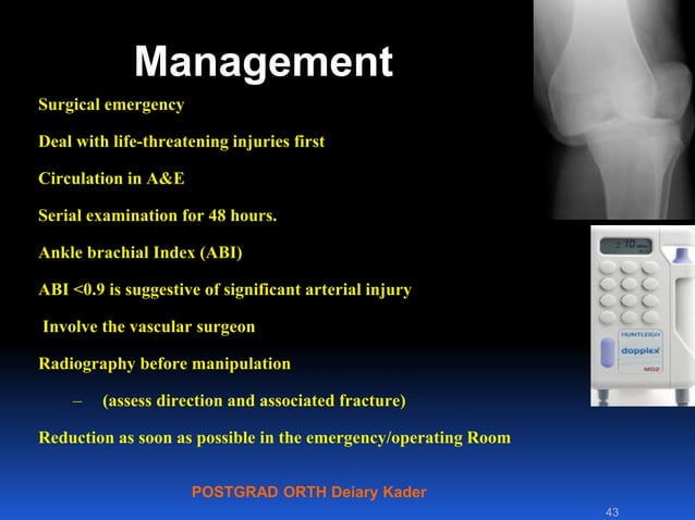 PCL, PLC, Knee Dislocation | PPTX | Death, Injury, or Military Conflict ...