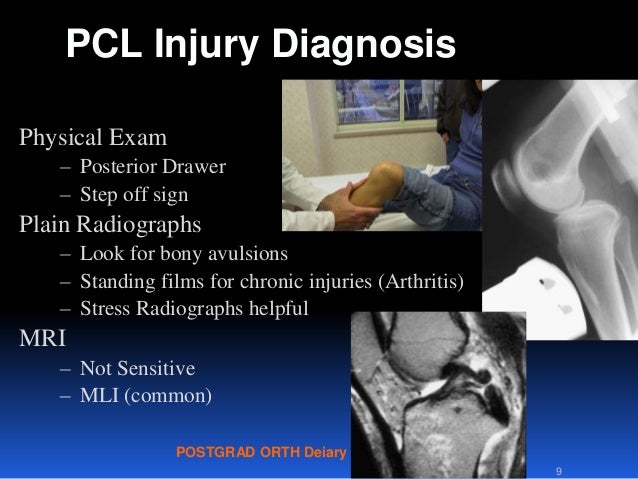 PCL, PLC, Knee Dislocation