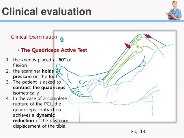 Posterior Cruciate ligament reconstruction, By Emad M. Qasem