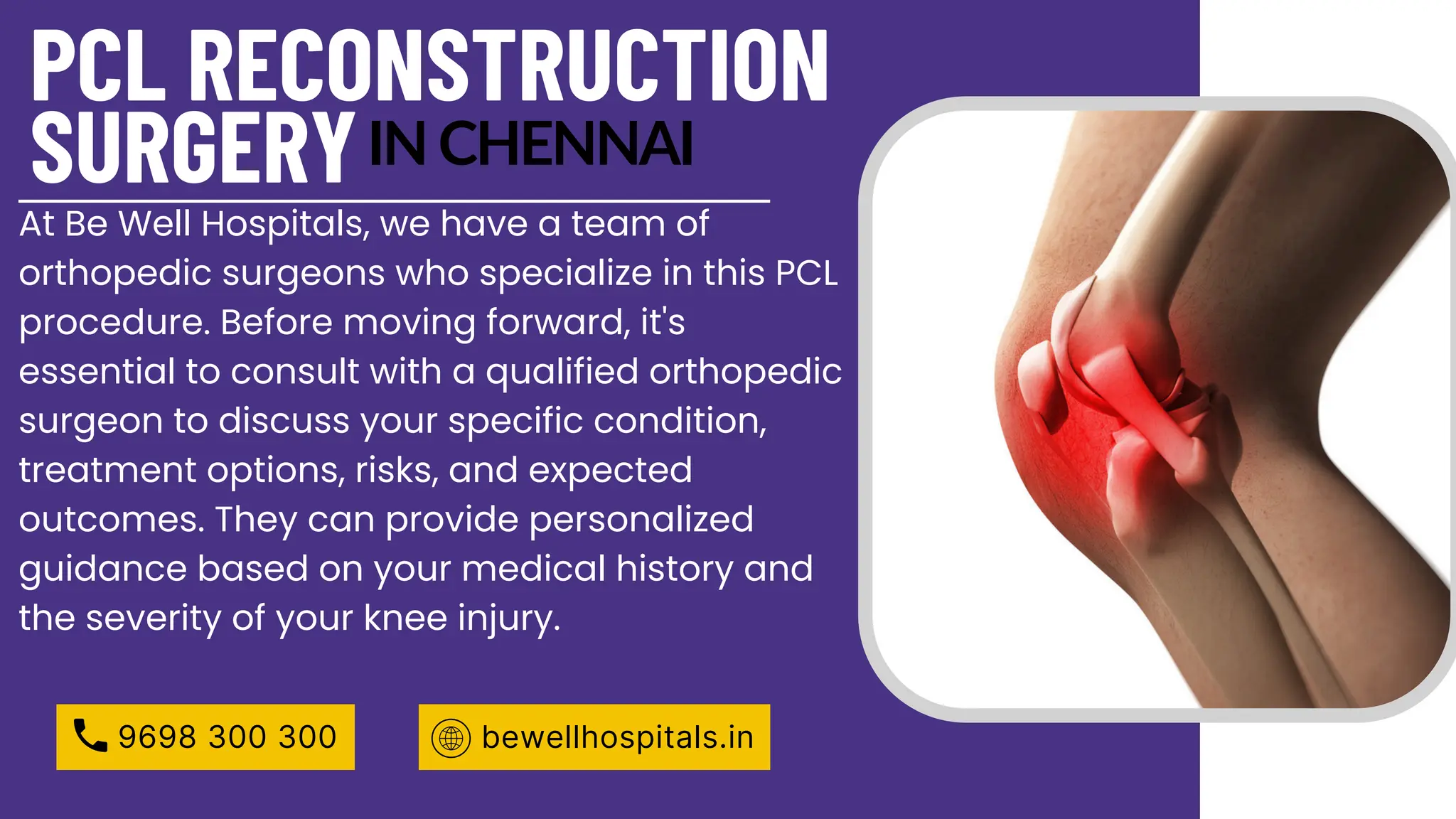 PCL Reconstruction Surgery in Chennai.pdf