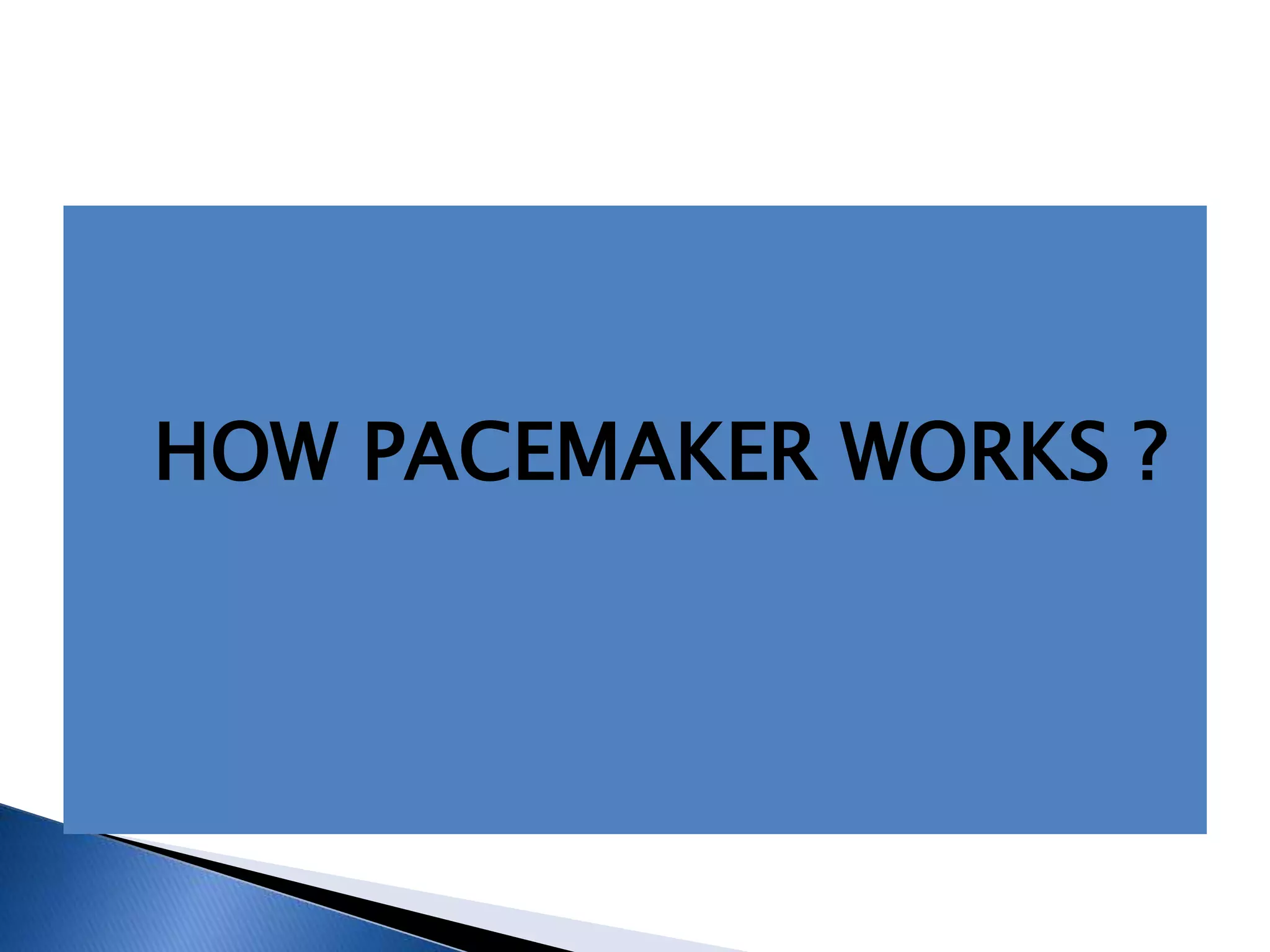 Pacemaker | PPTX
