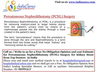 pcnl surgery in india | PPTX