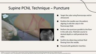 PCNL puncture Technique. Describe variation of puncture | PPTX