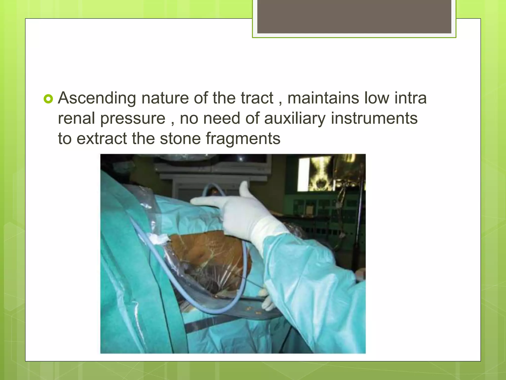 prone versus supine pcnl | PPTX