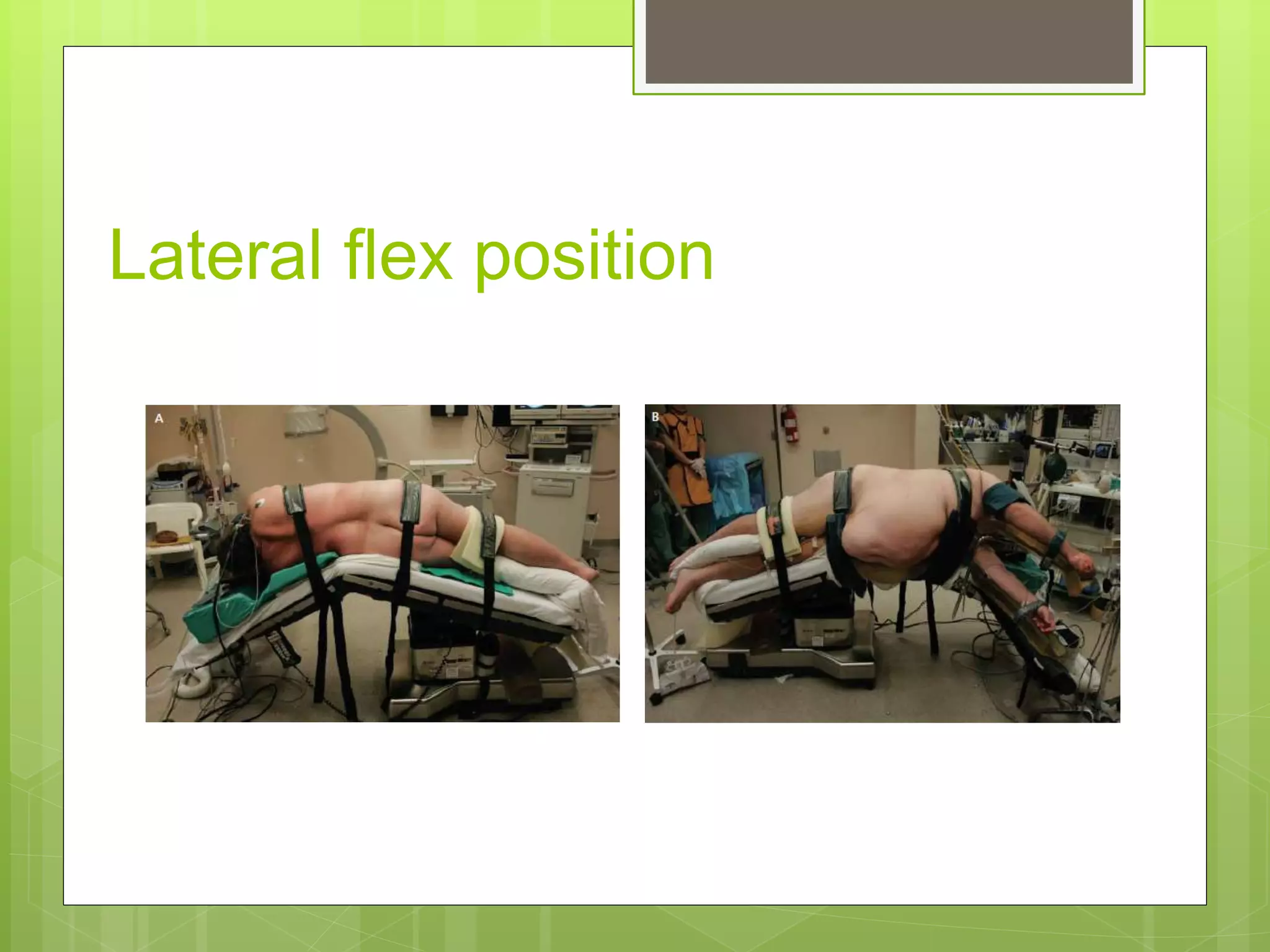prone versus supine pcnl | PPTX