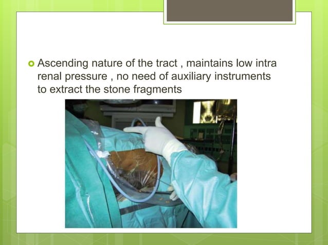 prone versus supine pcnl | PPTX | Surgery | Medical Health