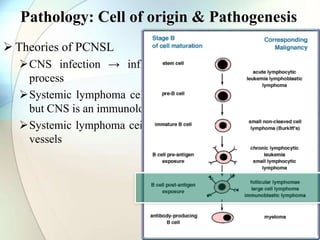 Primary CNS lymphoma | PPSX