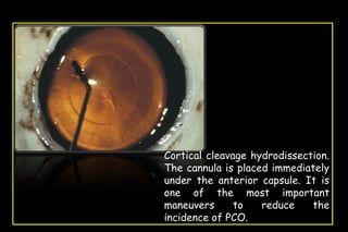 Pco - by dr. Heba mahmoud (M D) | PPT