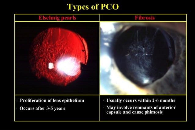 Pco - by dr. Heba mahmoud (M D)
