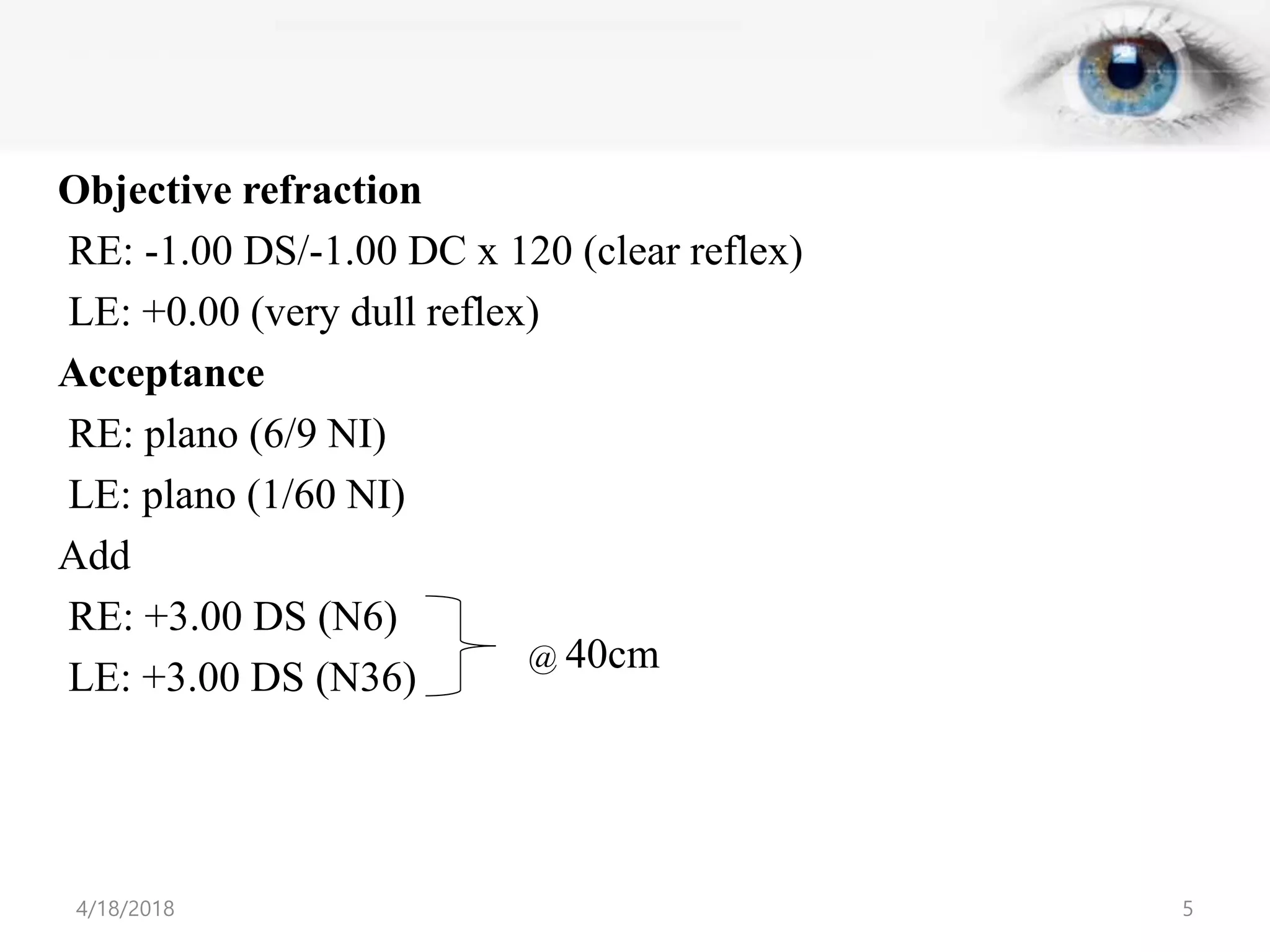 Posterior capsular opacification | PPTX