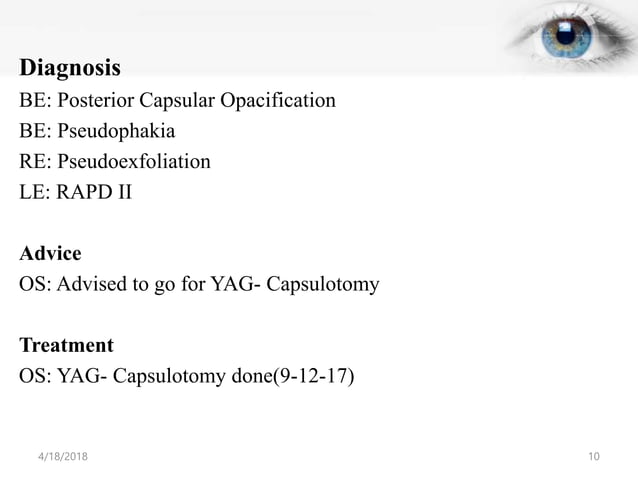 Posterior capsular opacification | PPTX | Eye and Vision Conditions ...
