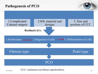 Posterior capsular opacification | PPTX | Eye and Vision Conditions ...