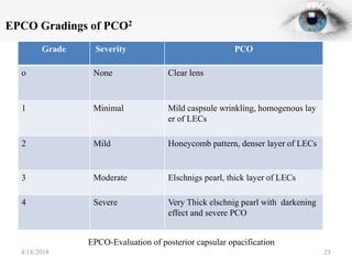 Posterior capsular opacification | PPTX