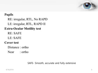 Posterior capsular opacification | PPTX