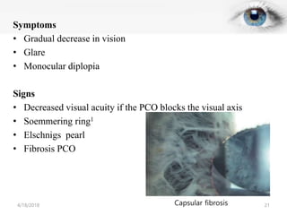 Posterior capsular opacification | PPT
