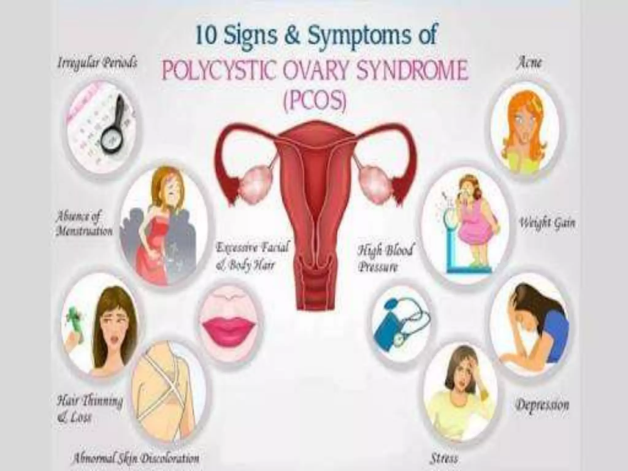 PCOD | PPTX