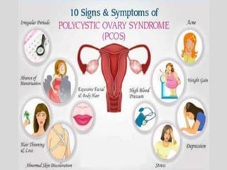 PCOD | PPTX