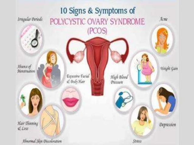 PCOD | PPTX
