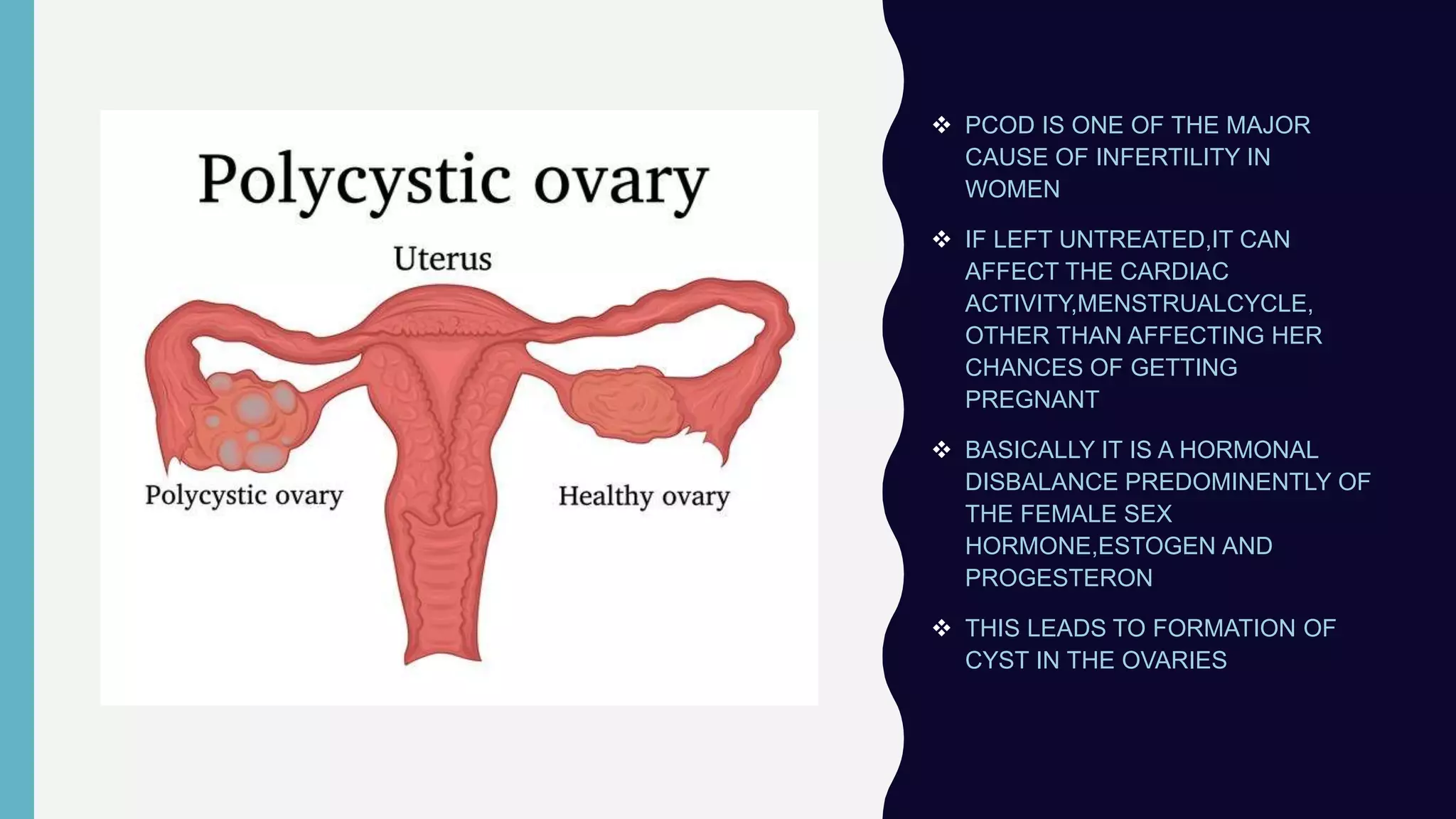PCOD/PCOS (polycystic ovarian disorder or polycystic ovarian syndrome ...