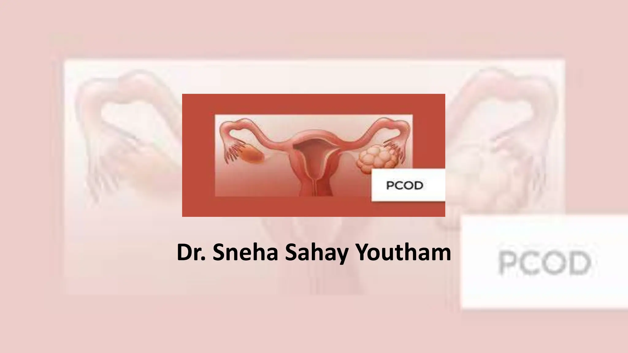 Polycystic ovarian Disease Causes & Prevention | PPTX